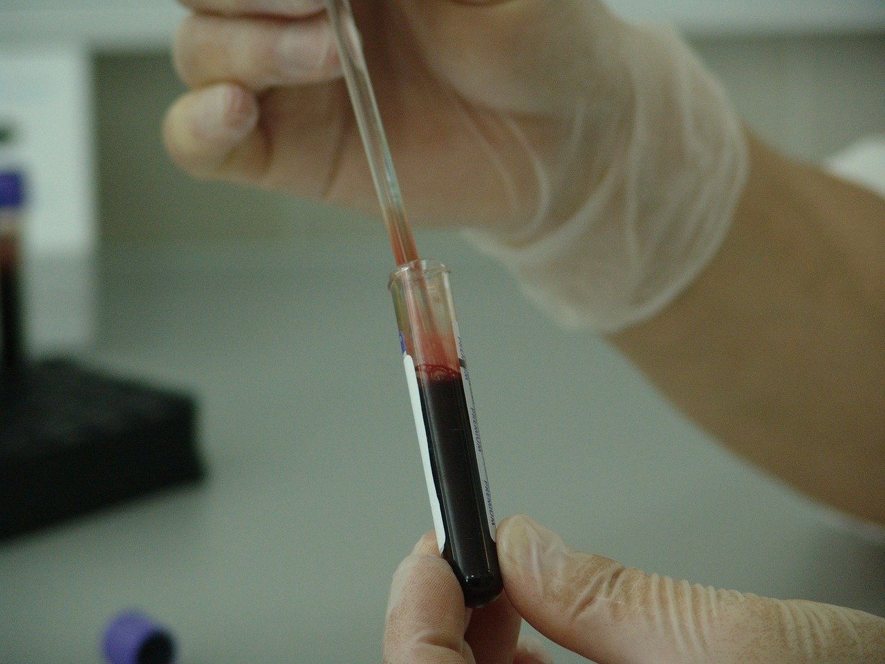 Akron Biotech to manufacture Human AB Serum for Octapharma