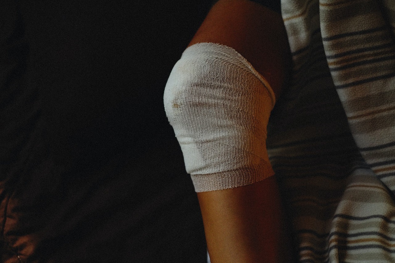 Japan’s MHLW approves MediWound’s burn treatment Nexobrid