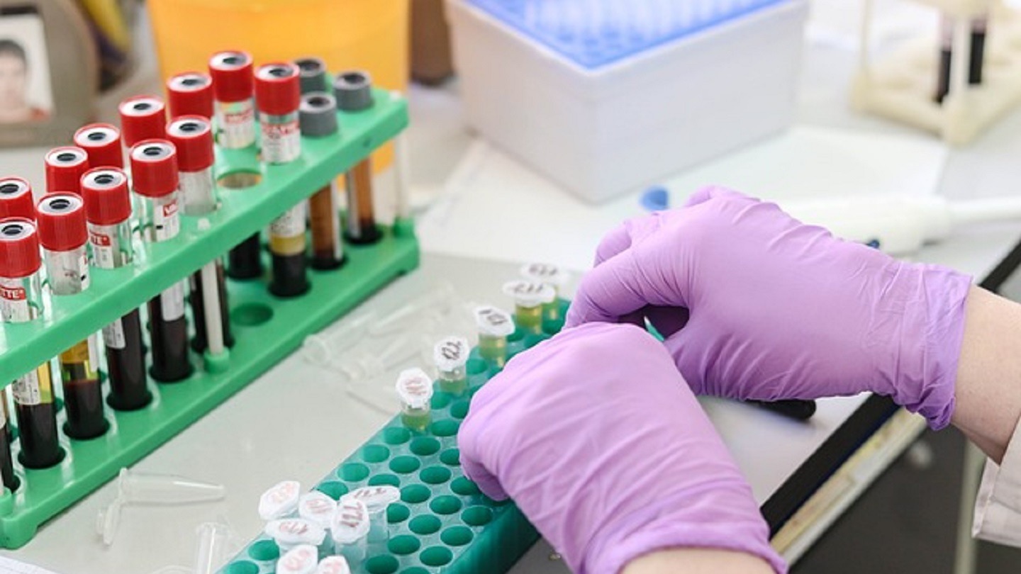 FDA clears 280Bio’s IND to start Phase I trial of YL-17231